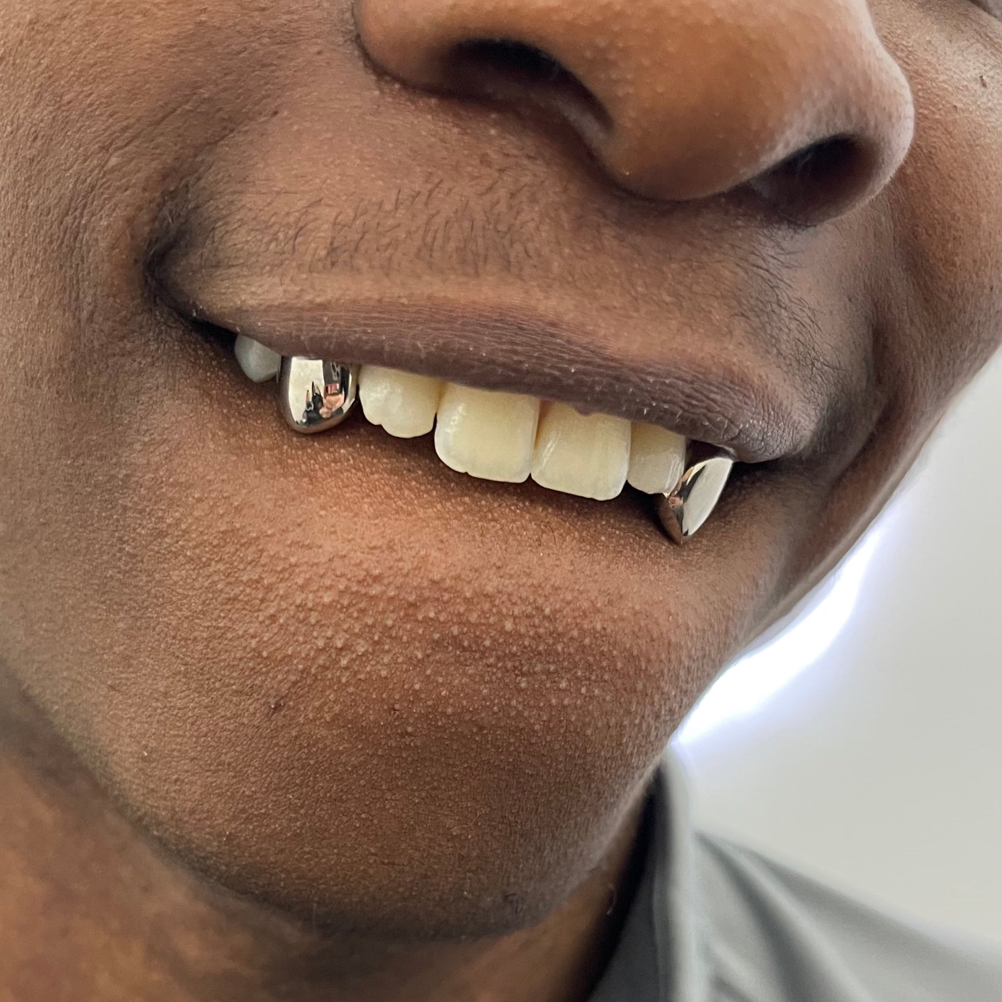 GOLD TOOTH CAPS – GrilledUpUK